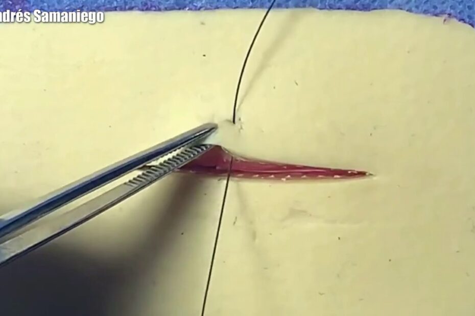 Descubre el Nudo Simple en Sutura: Guía Práctica