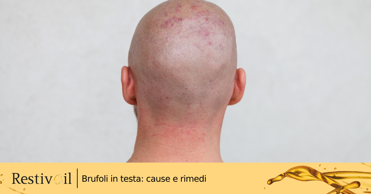Brufoli in testa: cause e rimedi | RestivOil